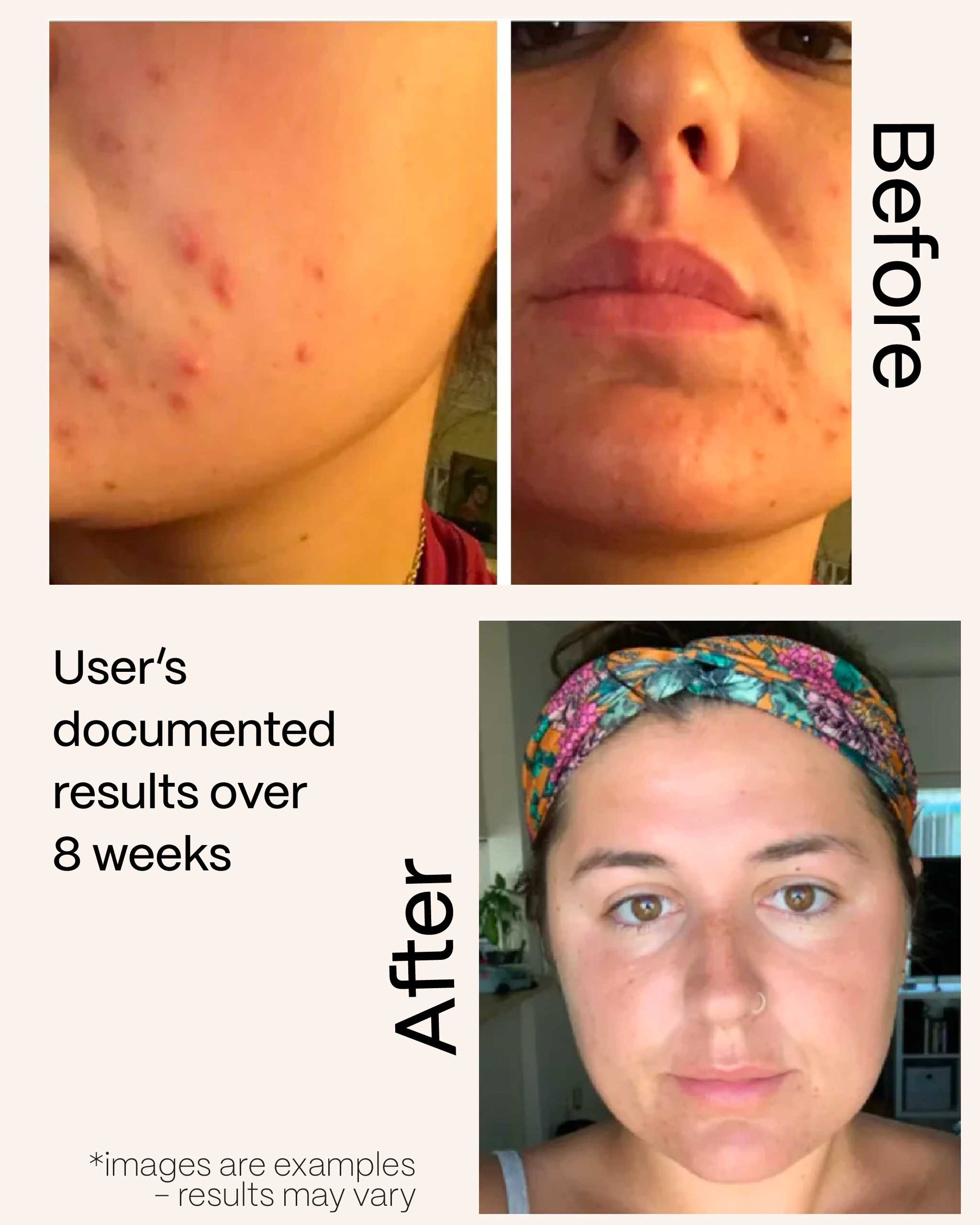 Clear Skin Routine | Mad Hippie